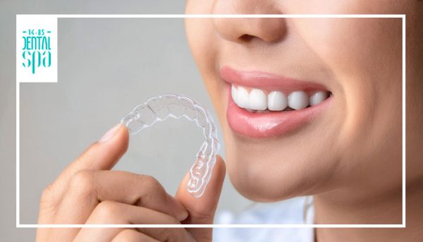 Retenedores: lo que debes saber para mantener tu ortodoncia